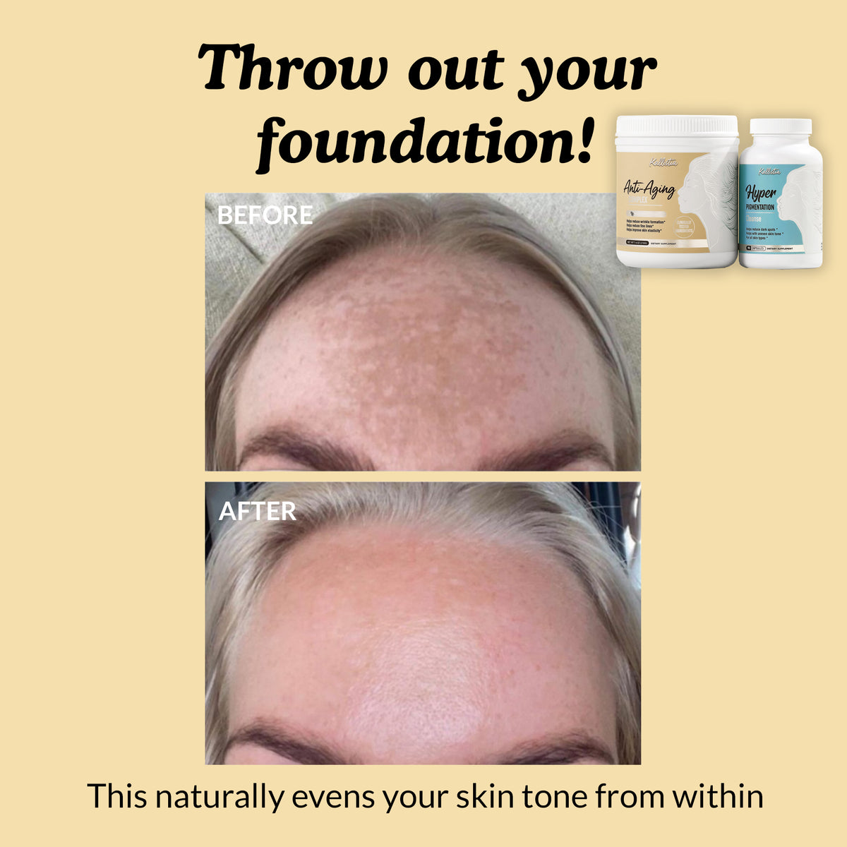 Hyper Renew Kit | kallistia