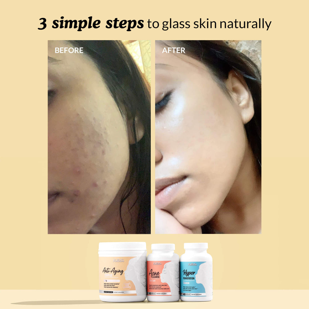 Perfect Skin Kit | kallistia