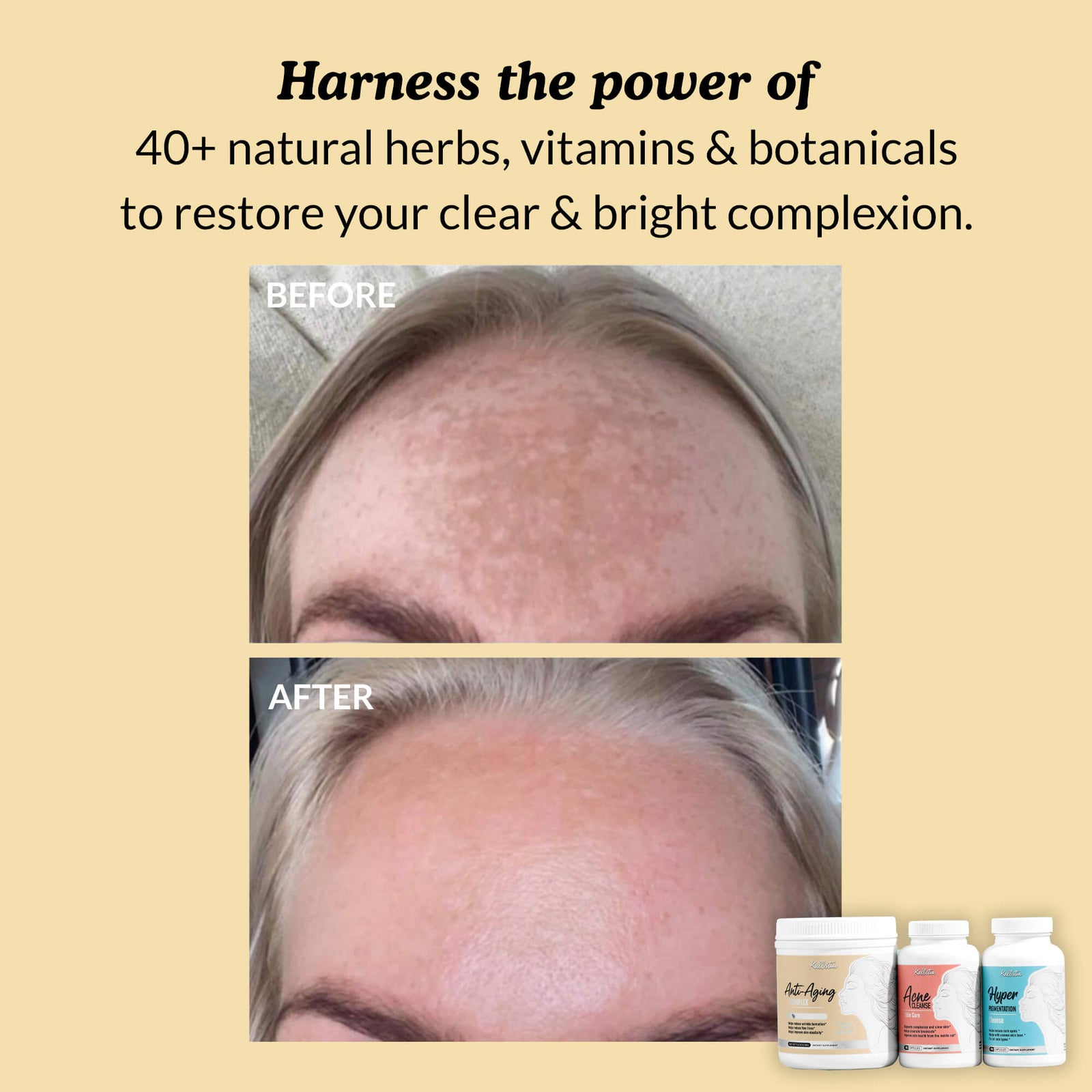 Perfect Skin Kit | kallistia