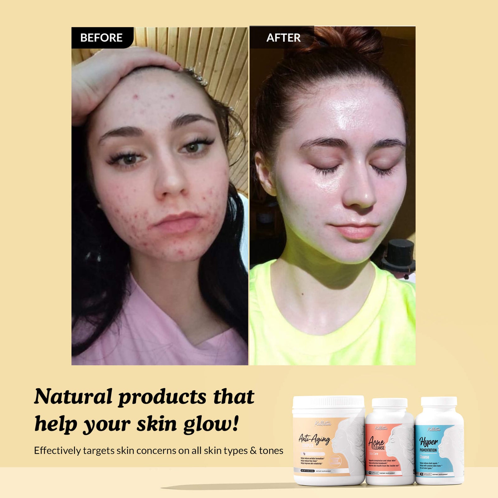 Perfect Skin Kit | kallistia