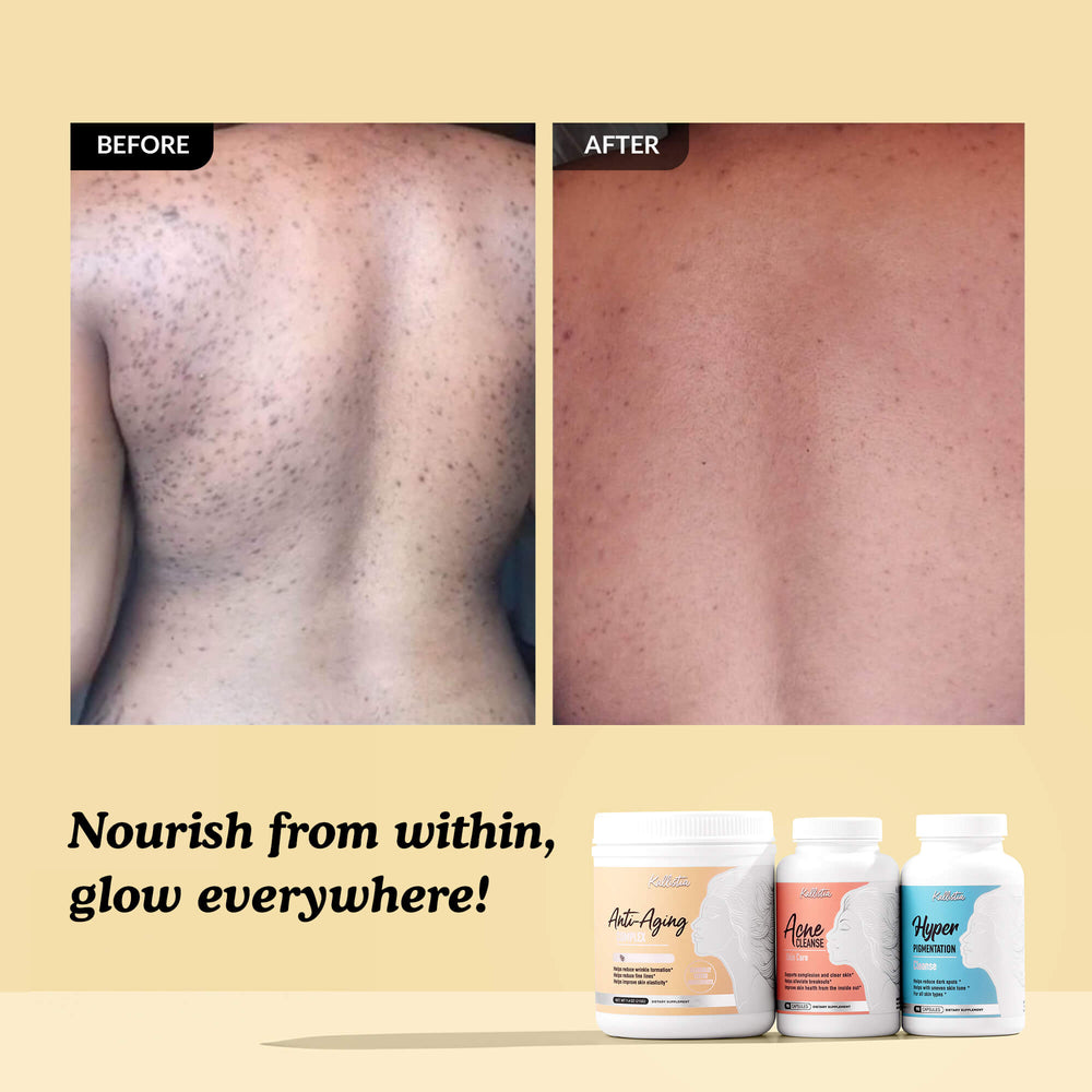 Perfect Skin Kit | kallistia