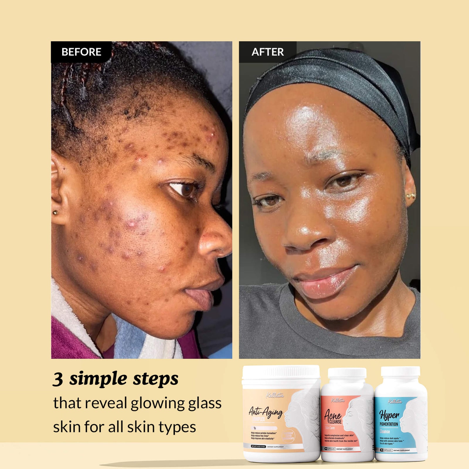 Perfect Skin Kit | kallistia