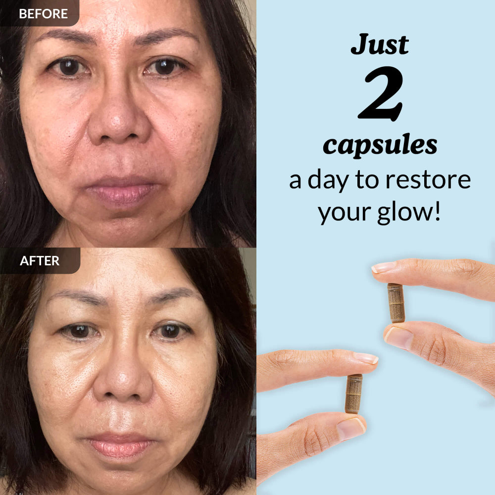 Hyperpigmentation Cleanse Capsules | kallistia