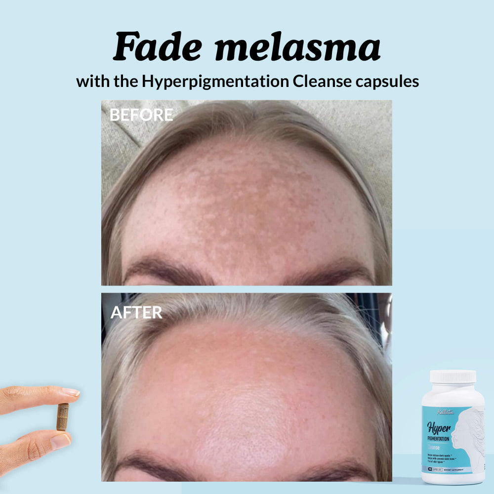 Hyperpigmentation Cleanse Capsules | kallistia