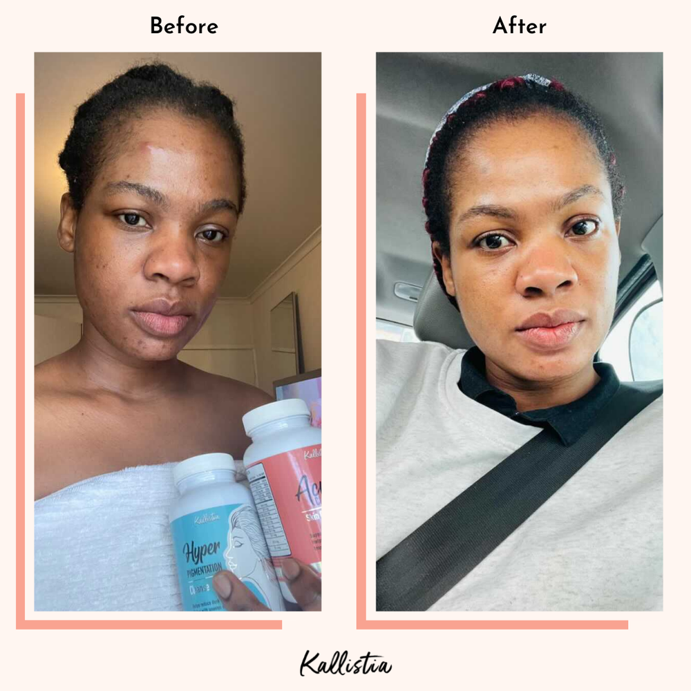 Kallistia - Perfect Skin Kit